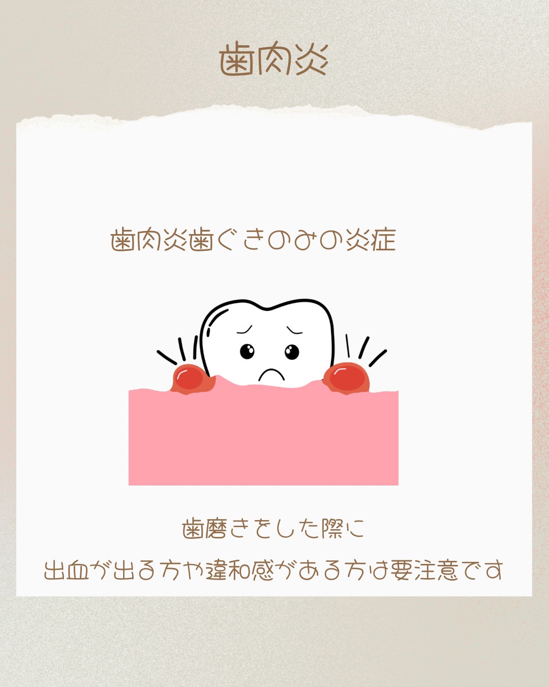 虫歯や歯周病は「早期発見」がとても大切です | 恵比寿・伊勢原の歯医者・歯科・インプラント・矯正・審美歯科・美容外科・美容皮膚科｜ピュアグループ